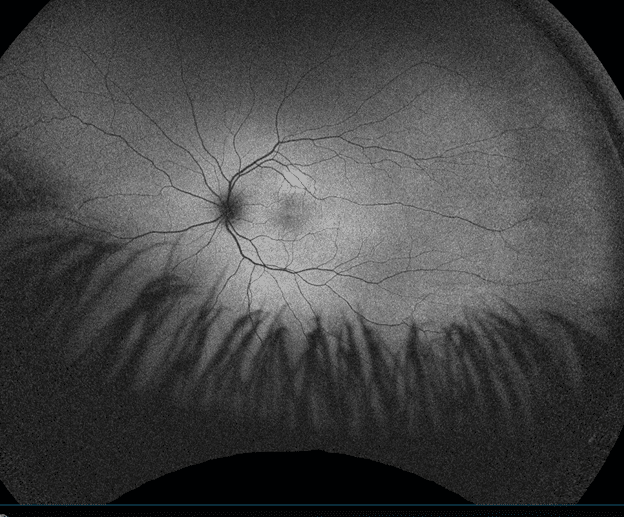 Retinal Review: February 2022