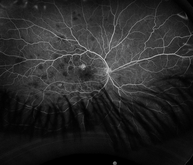 Retinal Review: February 2022