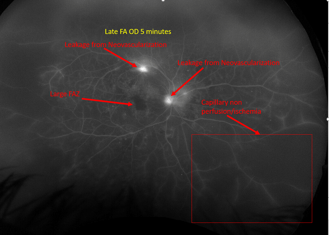 Retinal Review: May 2022 - OOMC